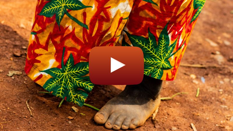 Video: Podoconiosis - from an unknown disease to a priority with ...